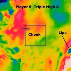 The Effects of Using the Cheek Muscles vs. the Chin Muscles When ...